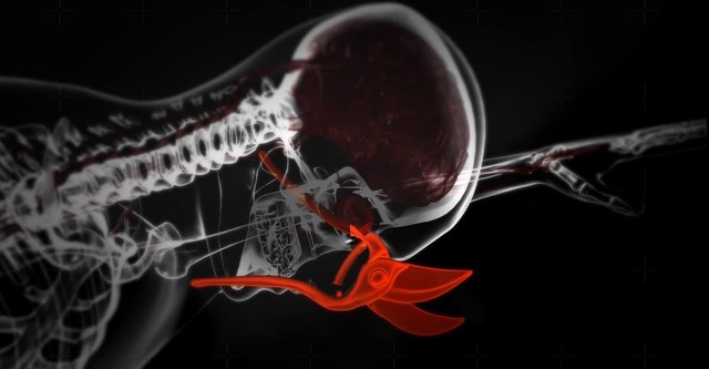 Body Invaders Season 1 - watch episodes streaming online