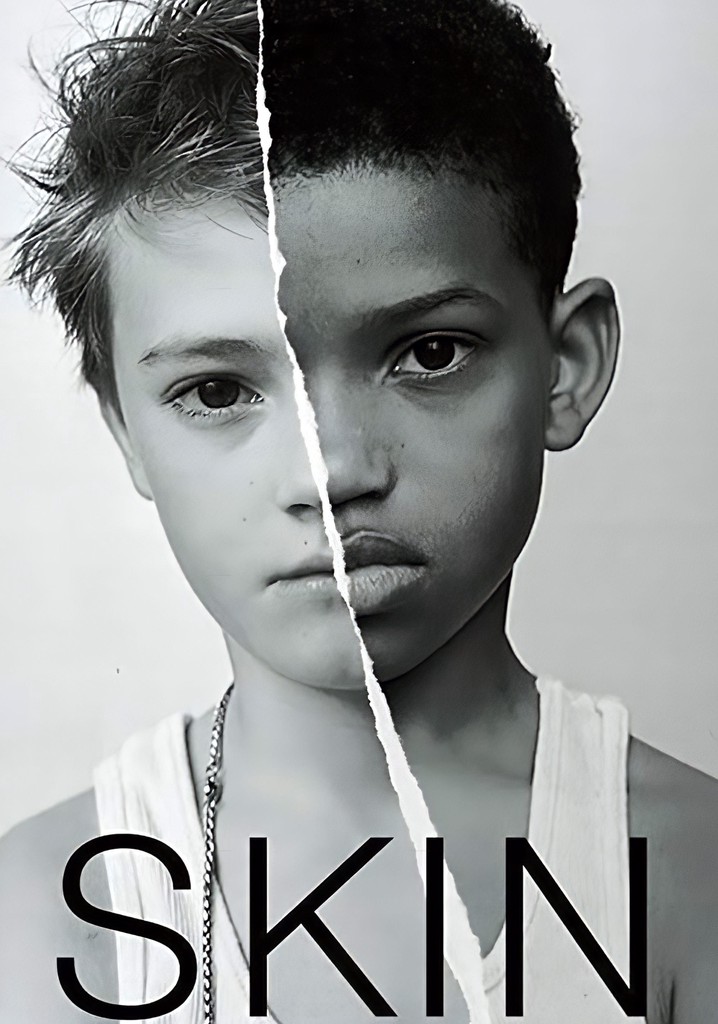 Skin streaming: where to watch movie online?