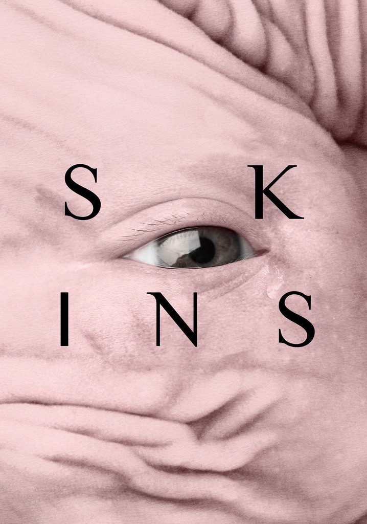 Pelle - film: dove guardare streaming online